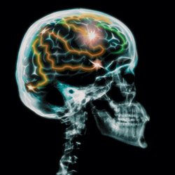 Lesiones Cerebrales